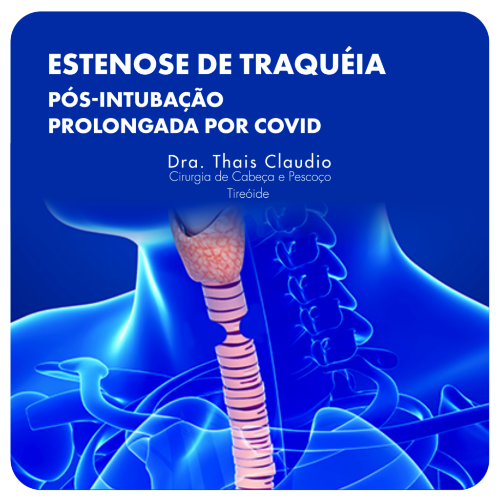 Estenose de Traquéia - CCP Clinic | Dra. Thais Claudio - Cirurgia ...