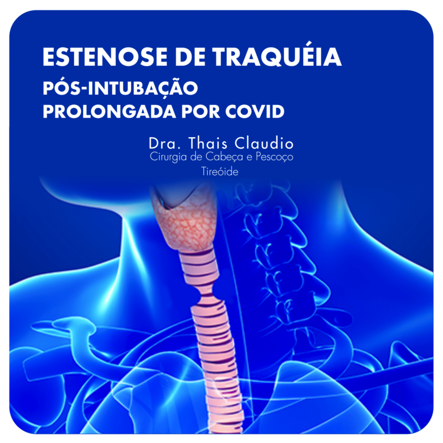 Estenose de Traquéia - CCP Clinic | Dra. Thais Claudio - Cirurgia ...
